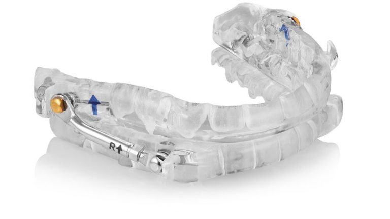 Oral Appliances — Sleep Better Illinois